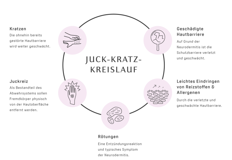Neurodermitis an der Hand: Wie man pflegt und vorbeugt